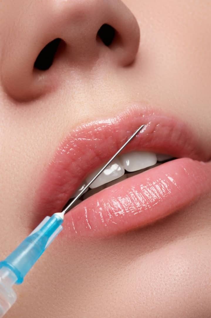 From Subtle Enhancement to Bold Volume: Choosing the Lip Filler for Yo ...